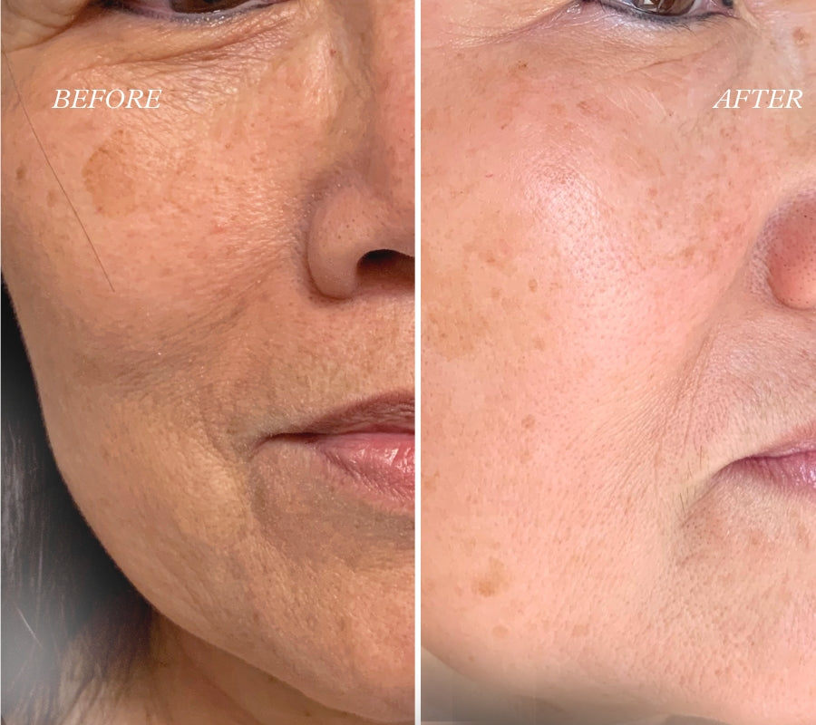 Weekly Oasis™ Facelift Gel Mask | Refill Set | Lā SEN Beauty