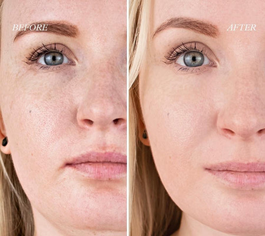 Weekly Oasis™ Facelift Gel Mask | Starter Kit | Lā SEN Beauty